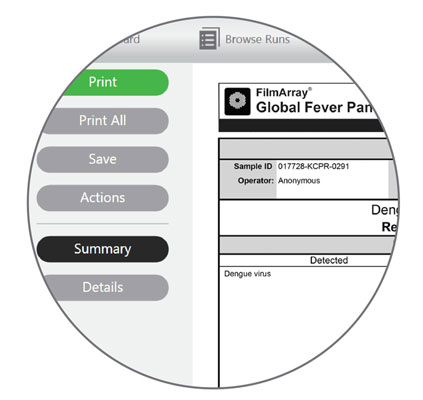 The BIOFIRE® FILMARRAY® TORCH System - BioFire Defense